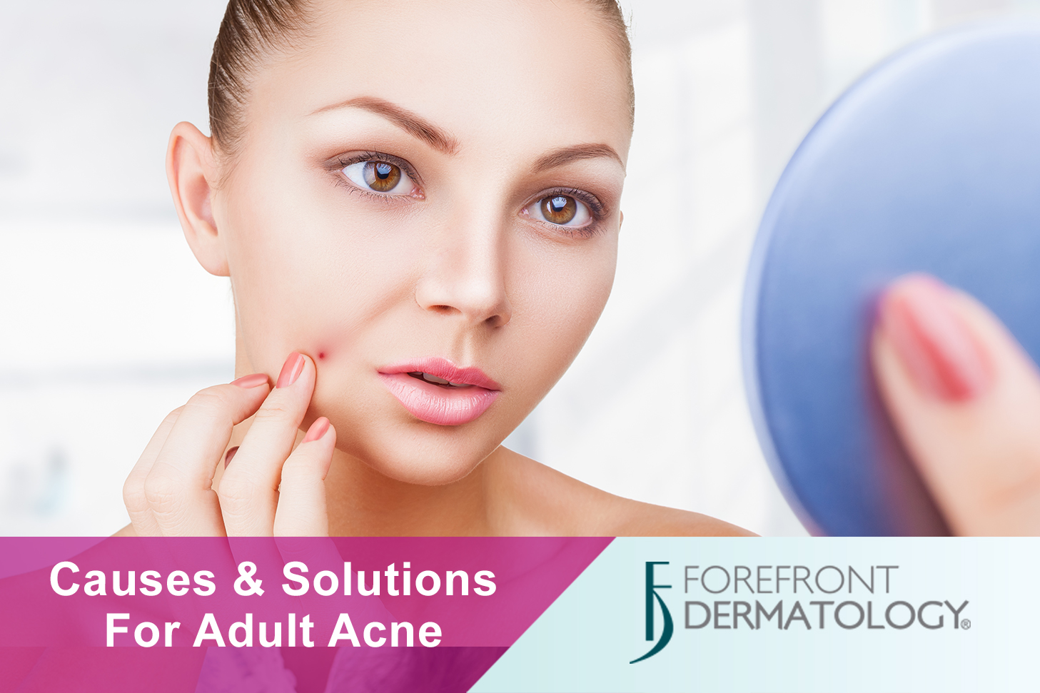 Causes and Solutions for Adult Acne - DermSpecialists