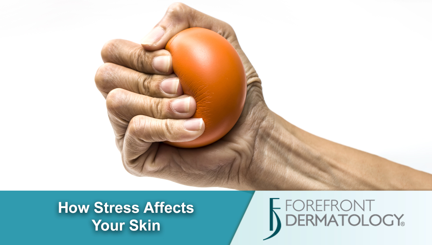 The Stress Effect – How Stress Impacts Skin Health - DermSpecialists